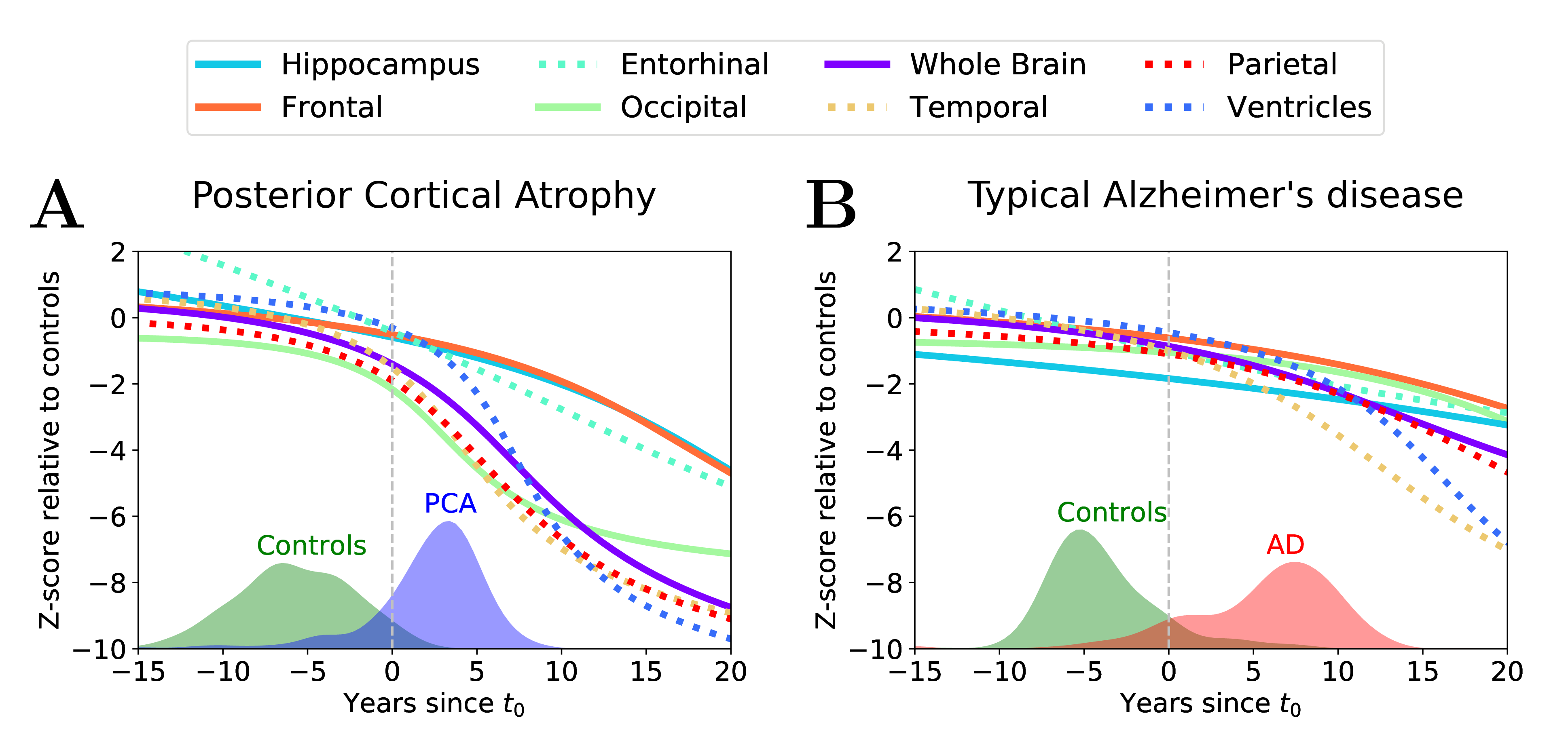 Longitudinal neuroanatomical and cognitive progression of posterior ...
